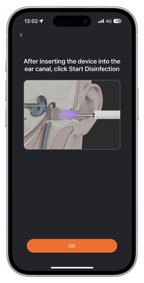 Test du Bebird Earvision: Un otoscope connecté pour nettoyer vos oreilles
