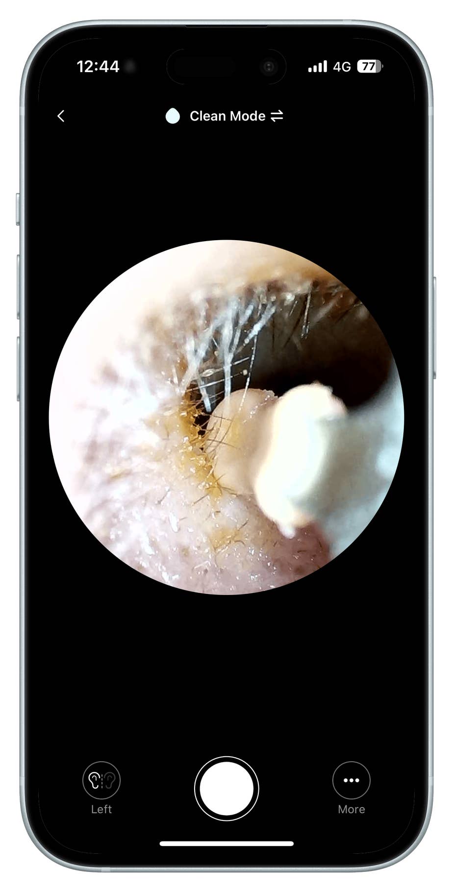 Test du Bebird Earvision: Un otoscope connecté pour nettoyer vos oreilles