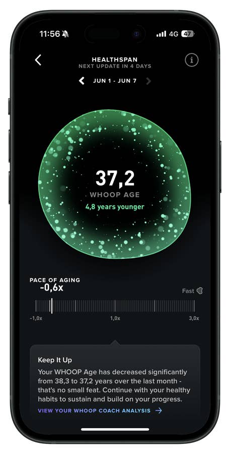 Test du Whoop MG : le dispositif portable le plus ingénieux pour votre ...